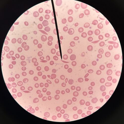 Hematology course gives Marquette students crucial experience in ...